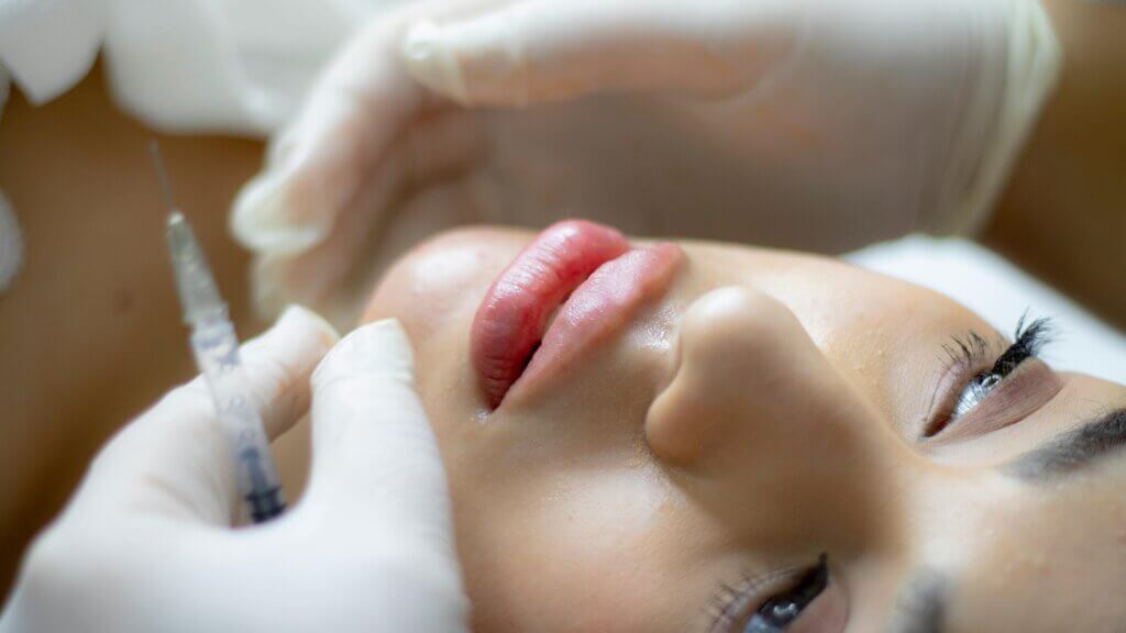 Best Lip Filler NY: Achieve the Perfect Pout at Derm Artisan - Derm Artisan
