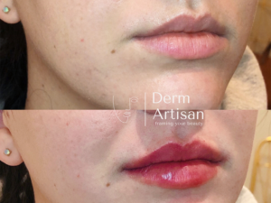 Medical Spa In New York NY | Derm Artisan